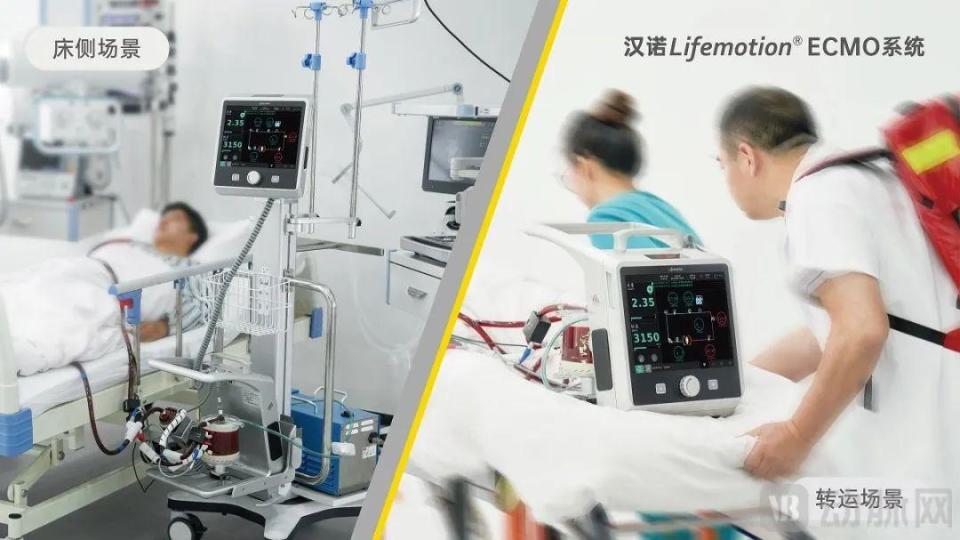 中国高端医疗装备创欧盟CE MDR首台套！来自汉诺医疗国产ECMO整机系统_腾讯新闻