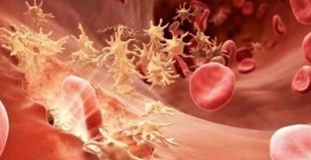 ORR高达71%！再生元公布靶向BCMA/CD3双抗Linvoseltamab在重度多发性骨髓瘤2期研究最新进展_腾讯新闻