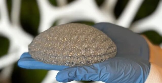 BellaSeno 3D打印乳房植入物试验取得成功，有望摆脱硅胶植入物_腾讯新闻