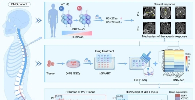 hLife | HiTIP-seq技术：为弥漫性中线胶质瘤治疗新策略提供新技术与科学依据_腾讯新闻