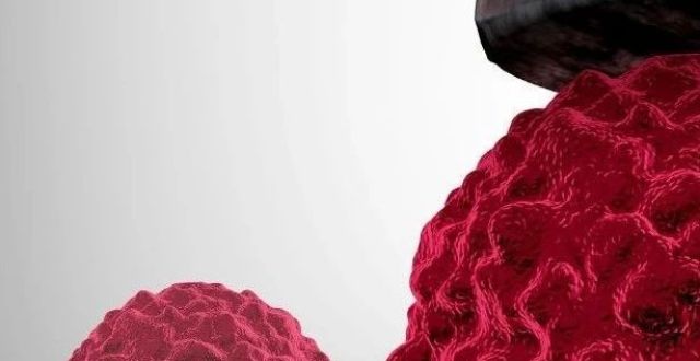 Cell：重磅综述确定了改善胰腺癌治疗的标志_腾讯新闻