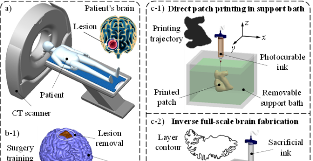 Brain-X：3D打印全尺寸人脑模型及临床应用前景_腾讯新闻