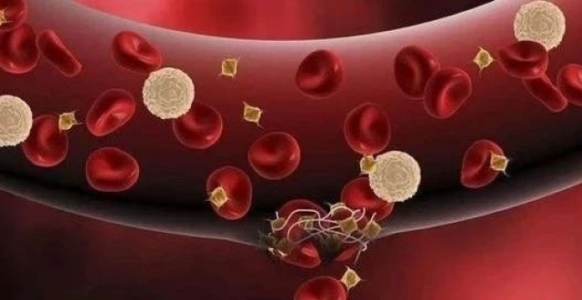 武田：“同类最佳”CD38单抗治疗原发性免疫性血小板减少症的 2 期研究达到积极顶线结果_腾讯新闻