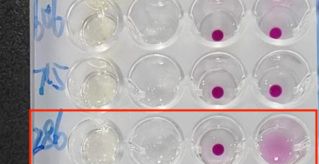 TP-Ab阴性、RPR阴性、TPPA阳性，怎么看？_腾讯新闻