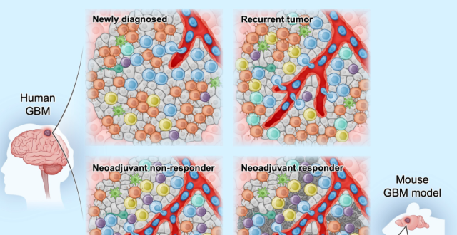 Nature Cancer | 陈俊团队揭示GBM新靶点：巨噬细胞免疫检查点Siglec-9_腾讯新闻