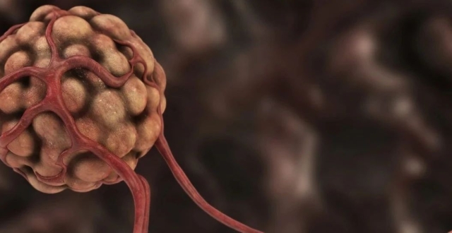 NEJM：NICHE-2研究登顶！pCR率达68%，26个月的DFS为100%，有望成为局晚期dMMR结肠癌治疗新标准_腾讯新闻