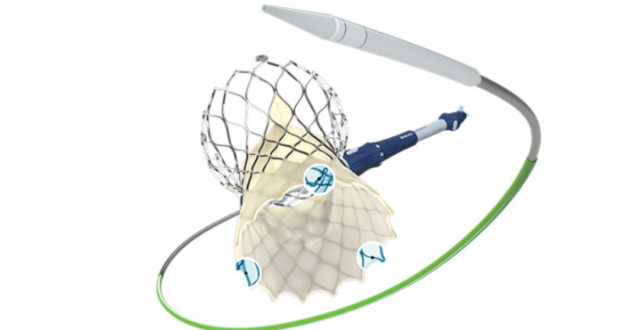美敦力TAVR有重大成果_腾讯新闻