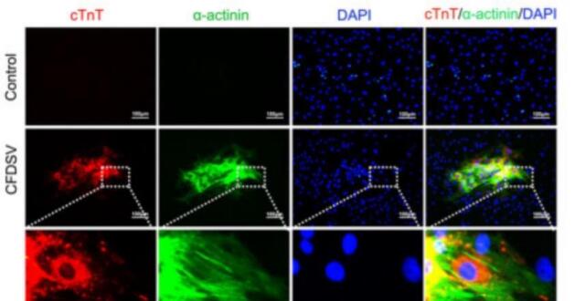 AbMole明星分子：SB431542抑制TGF-β通路，干细胞、纤维化与肿瘤研究的多面手_腾讯新闻