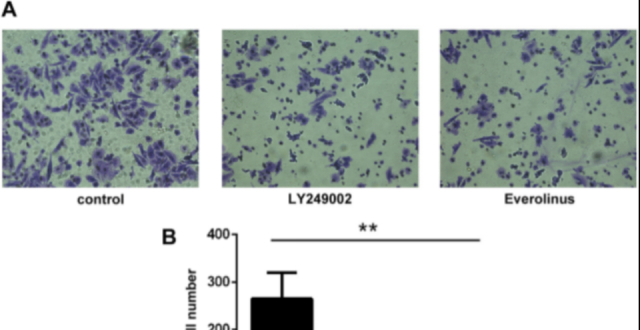 AbMole 丨LY294002：PI3K/AKT 通路研究的“超级英雄”，让你的实验腾飞_腾讯新闻