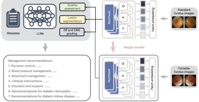 国际首个，我国团队开发糖尿病诊疗多模态大模型 DeepDR-LLM_腾讯新闻