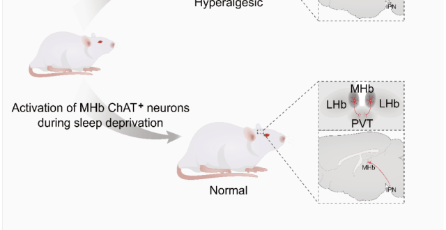 Neurosci Bull最新︱北京大学王韵教授：内侧缰核胆碱能神经元介导睡眠剥夺引起的痛觉过敏_腾讯新闻