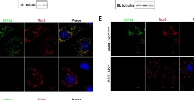 JV | 细胞通过IRF8-MicroRNA-10a-SRP14调控途径抵抗PRRS感染_腾讯新闻