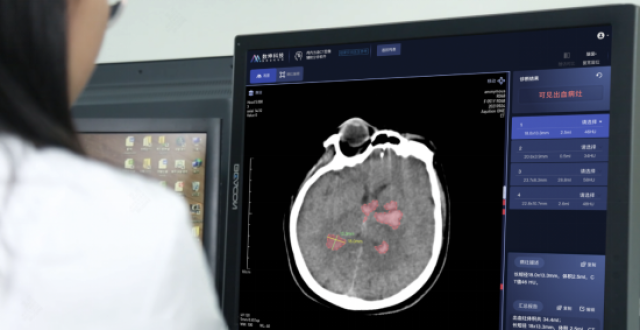 颅内出血AI软件获NMPA三类证_腾讯新闻