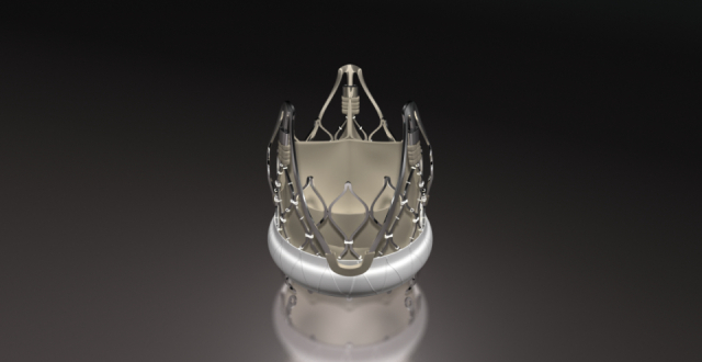 健世科技：Ken-Valve注册申请获国家药品监督管理局正式受理；LuX-Valve Plus入选欧洲临床专家委员会科学建议试点_腾讯新闻