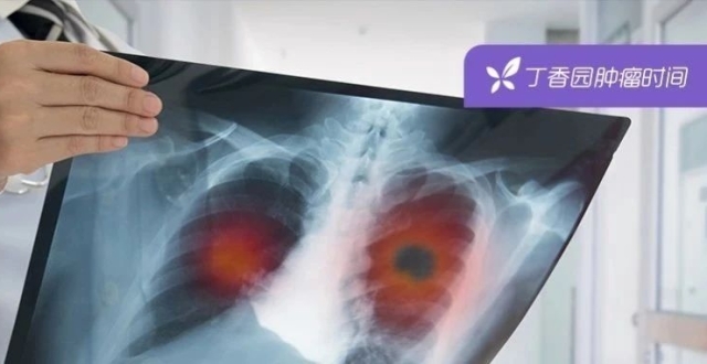 奥希替尼联合化疗一线 PFS 提升 9 个月！FLAURA2 研究者重磅解读 | WCLC 2023_腾讯新闻