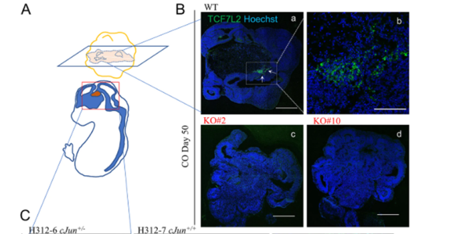丘脑发育的“指挥官”与神经科学新突破！Cell Biosci｜类器官揭示c-JUN基因奥秘_腾讯新闻