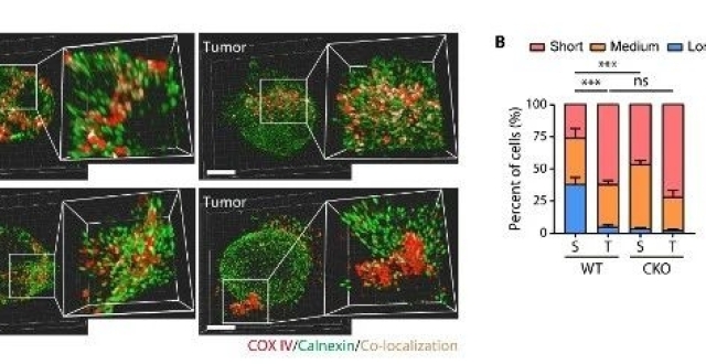 Sci Immunol. | 白凡团队与合作者发现肿瘤浸润CD8+ T细胞代谢适应和效应功能维持的新机制_腾讯新闻