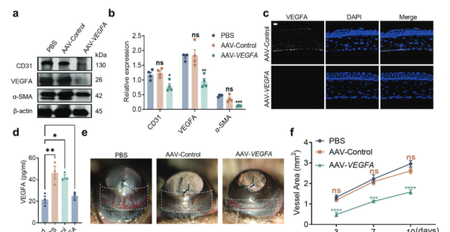 Adv Sci：黄锦海/周行涛团队使用AAV介导的CRISPR基因编辑治疗角膜新生血管_腾讯新闻