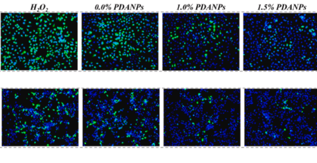 AbMole小课堂 | 活性氧(ROS)检测探针H2DCFDA：原理及应用全解析_腾讯新闻