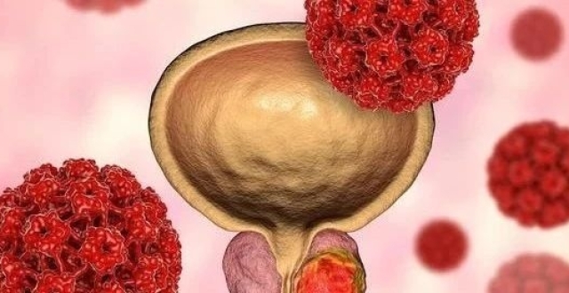 Arvinas：在ESCO更新了AR 降解剂Bavdegalutamide、ARV-766 的最新研究数据_腾讯新闻