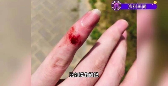 小心！女生做美甲竟感染hpv 医生提醒腾讯新闻
