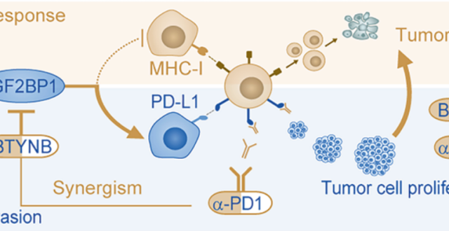 STTT：抑制RNA结合蛋白，增强卵巢癌免疫治疗_腾讯新闻